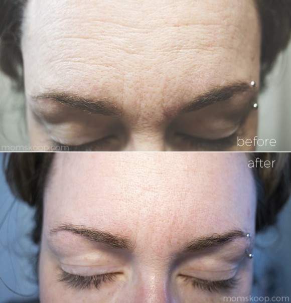 SkinPro BIO-Placenta Revitalizing Serum - Two Week Results & Review ...